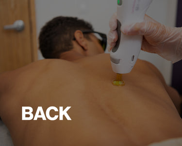 Laser Hair Removal | European Wax Center